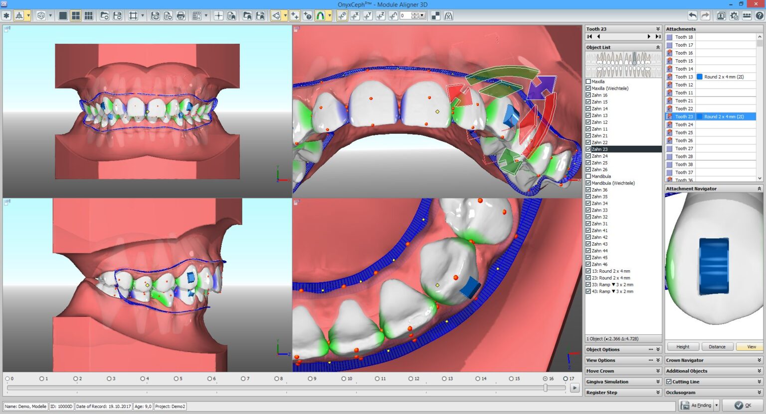 Ortho-Automation – Automatic aligner trimming for everyone!