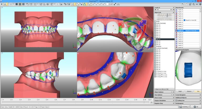 Ortho-Automation – Automatic aligner trimming for everyone!
